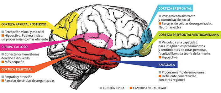Áreas cerebrales donde las personas con autismo procesan la información ...